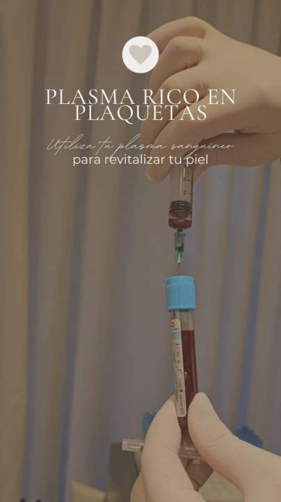 PLASMA RICO EN PLAQUETAS - Spa. Estetica. Centros de Estética. Centros ...