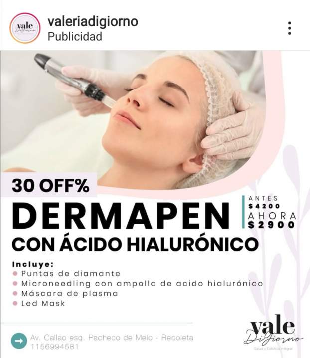 DERMAPEN + MICRODERMOABRASION + LED MASK $2900 - Spa. Estetica. Centros ...